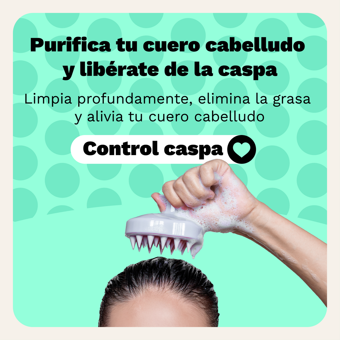 Control Caspa Natural – Ginger Milk Be Free – Ginger Milk Natural Care ...